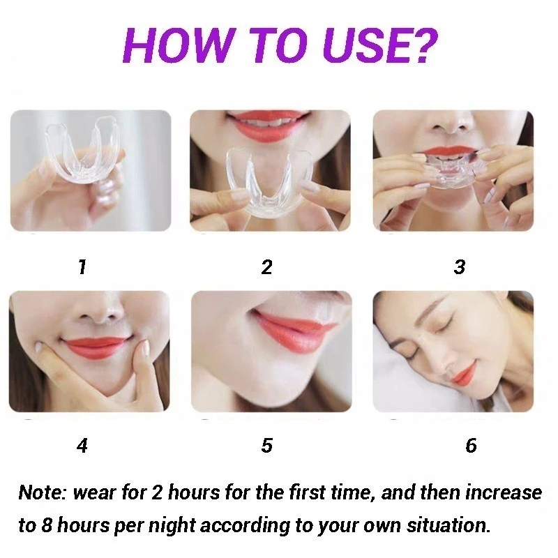 Teeth Orthodontic Appliance Alignment Teeth Retainer Bruxism Mouth ...