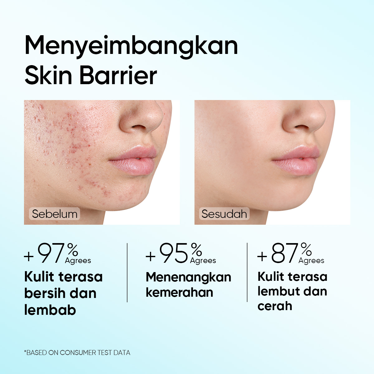 SKINTIFIC Amino Acid Gentle Cleansing Mousse pencuci muka Acne Oil ...