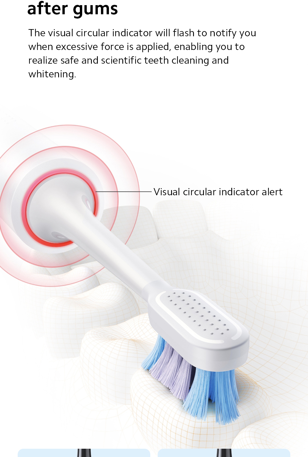Xiaomi Smart Electric Toothbrush T501 | 30 Custom Solutions | Over-Pressure Alerts | IPX8 ...