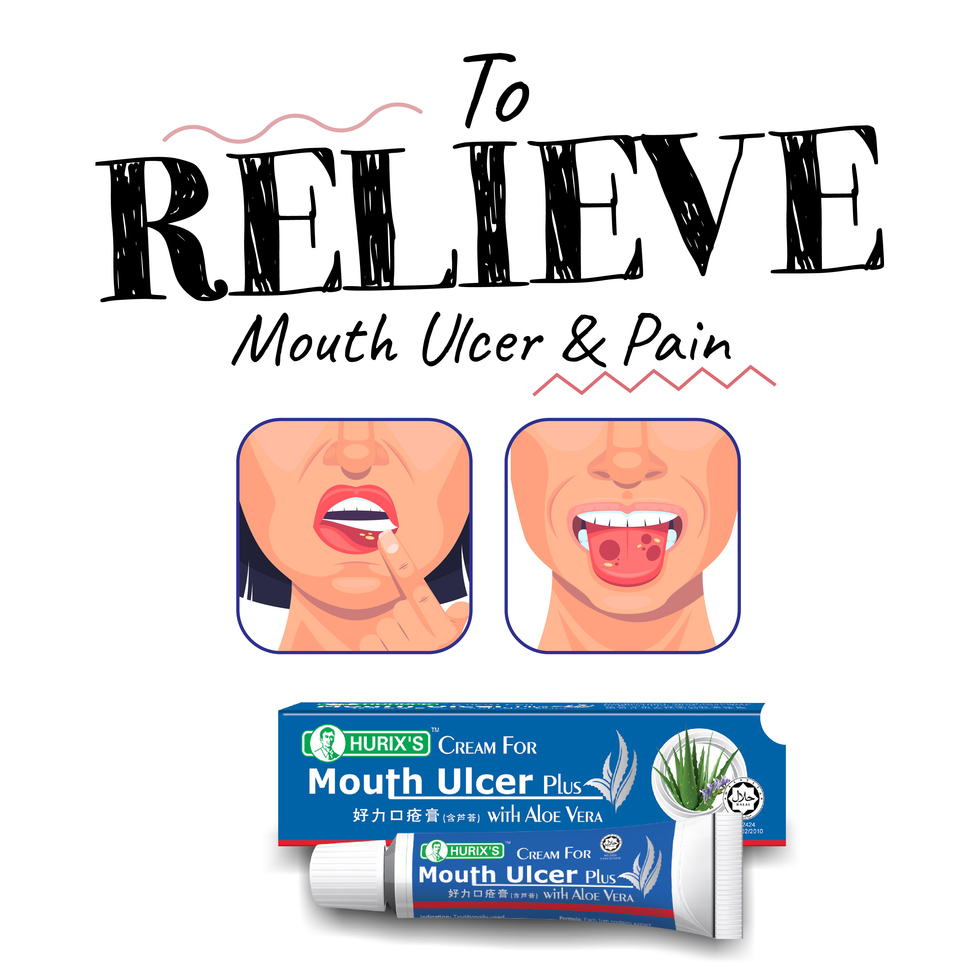 HURIX'S Cream For Mouth Ulcer Plus (with Aloe Vera) - Ulser Mulut ...