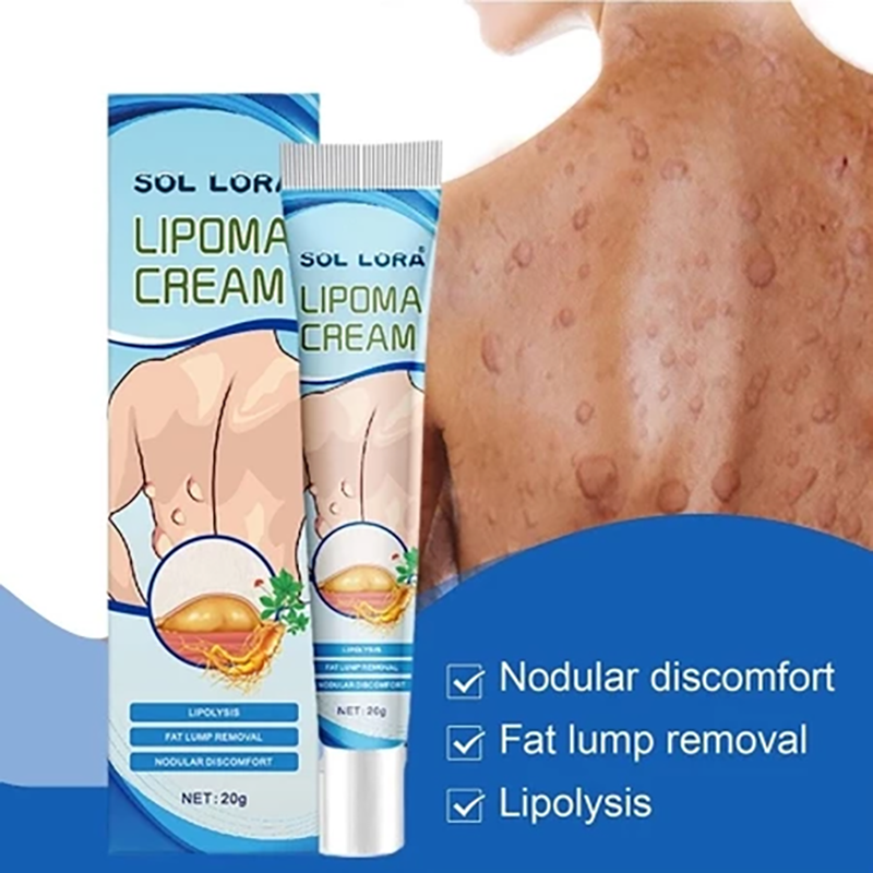 【Ready Stock】Upgraded 20g Lipoma Removal Cream Lipolysis Fat Lump ...