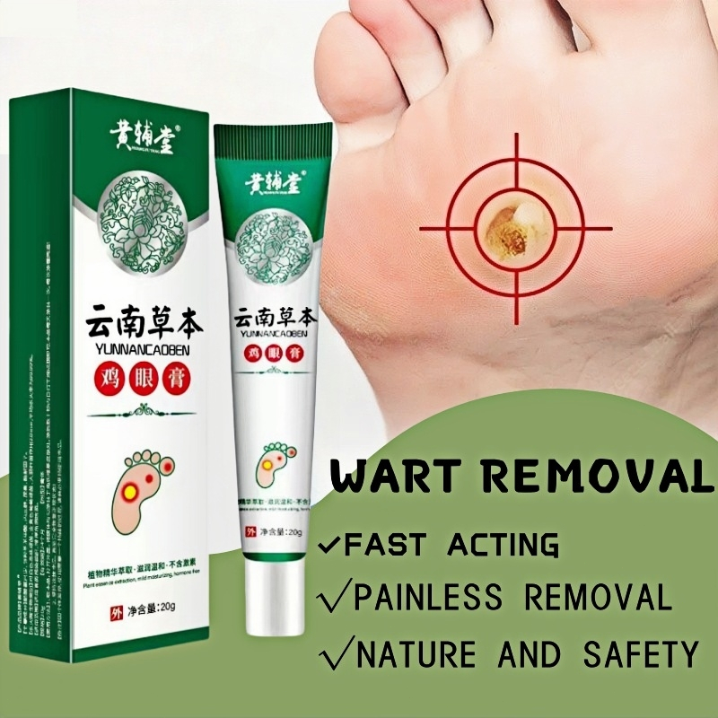 warts removal cream ubat ketuat tapak kaki skin tag wart remover ubat kutil paling berkesan foot ...