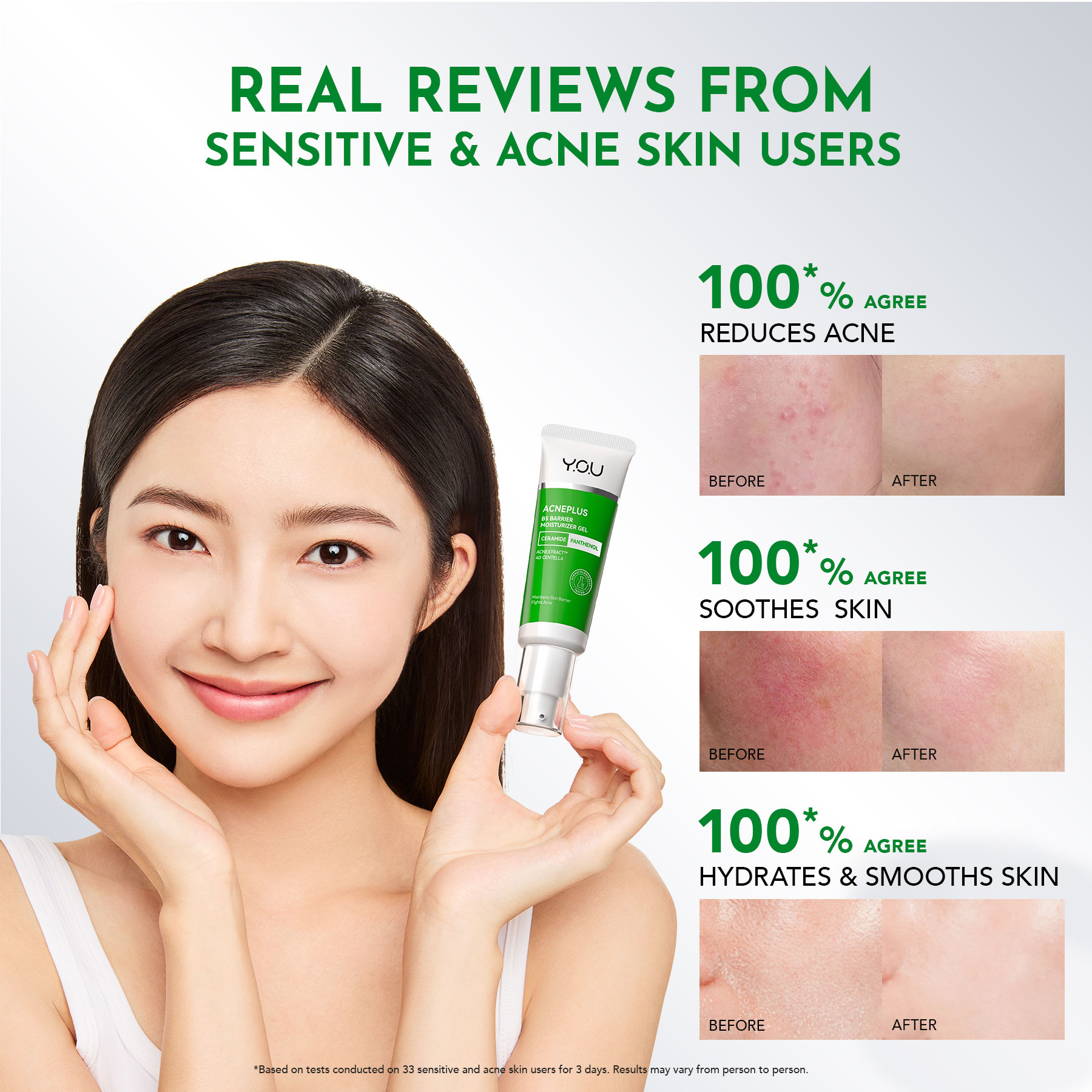 YOU Acneplus B5 Barrier Moisturizer Gel 30g Bundle Set Acid Toner Pro ...