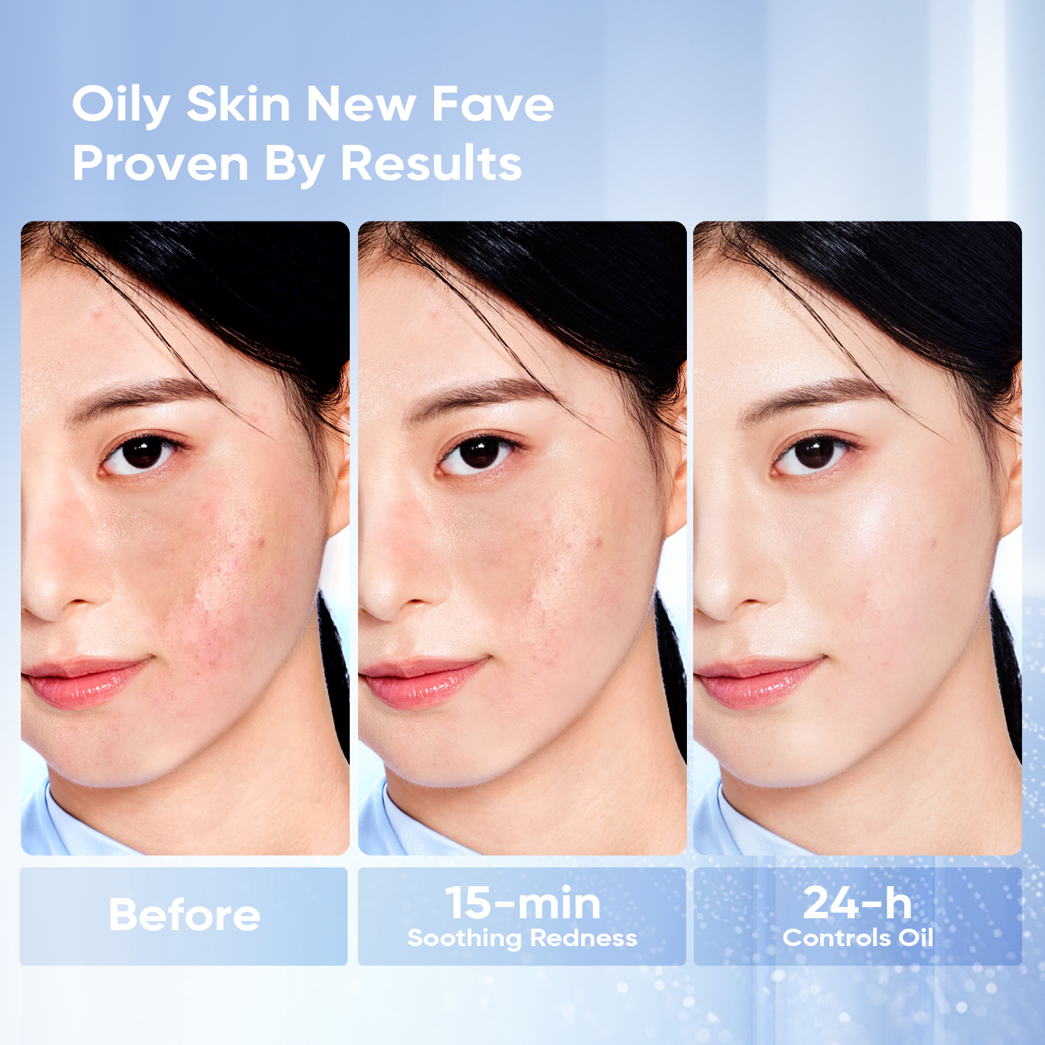 SKINTIFIC 5X Ceramide Moisture Gel Light-Texture Oil-control ...