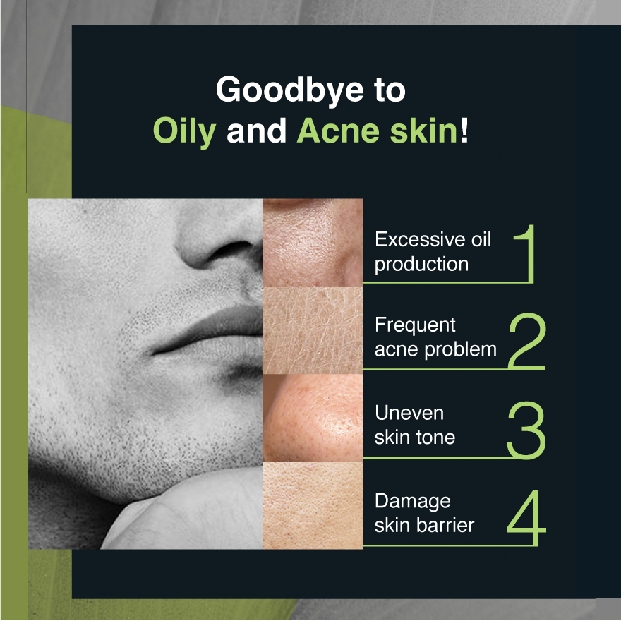 Mentholatum Men Anti-Acne Face Wash 150ml | Shopee Malaysia