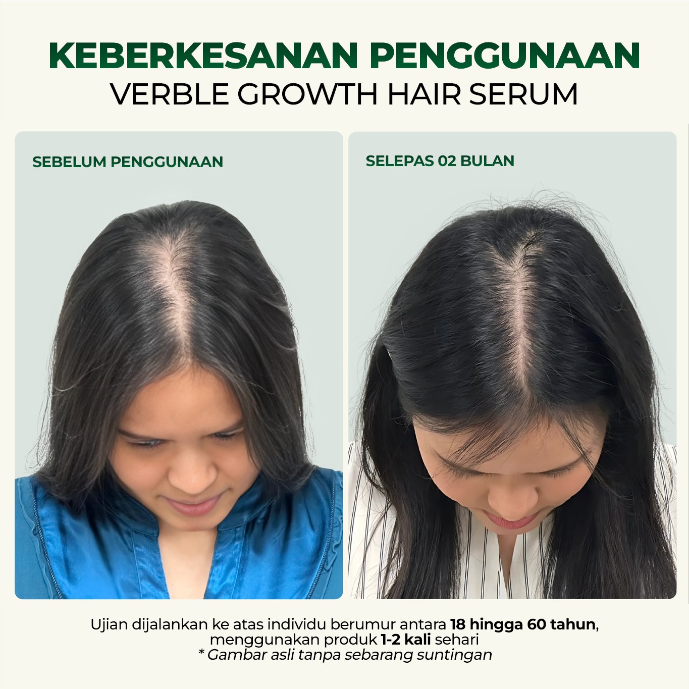 Verble Hair Growth Serum Erhair Regrowth Loss Fast For Hair Growth ...