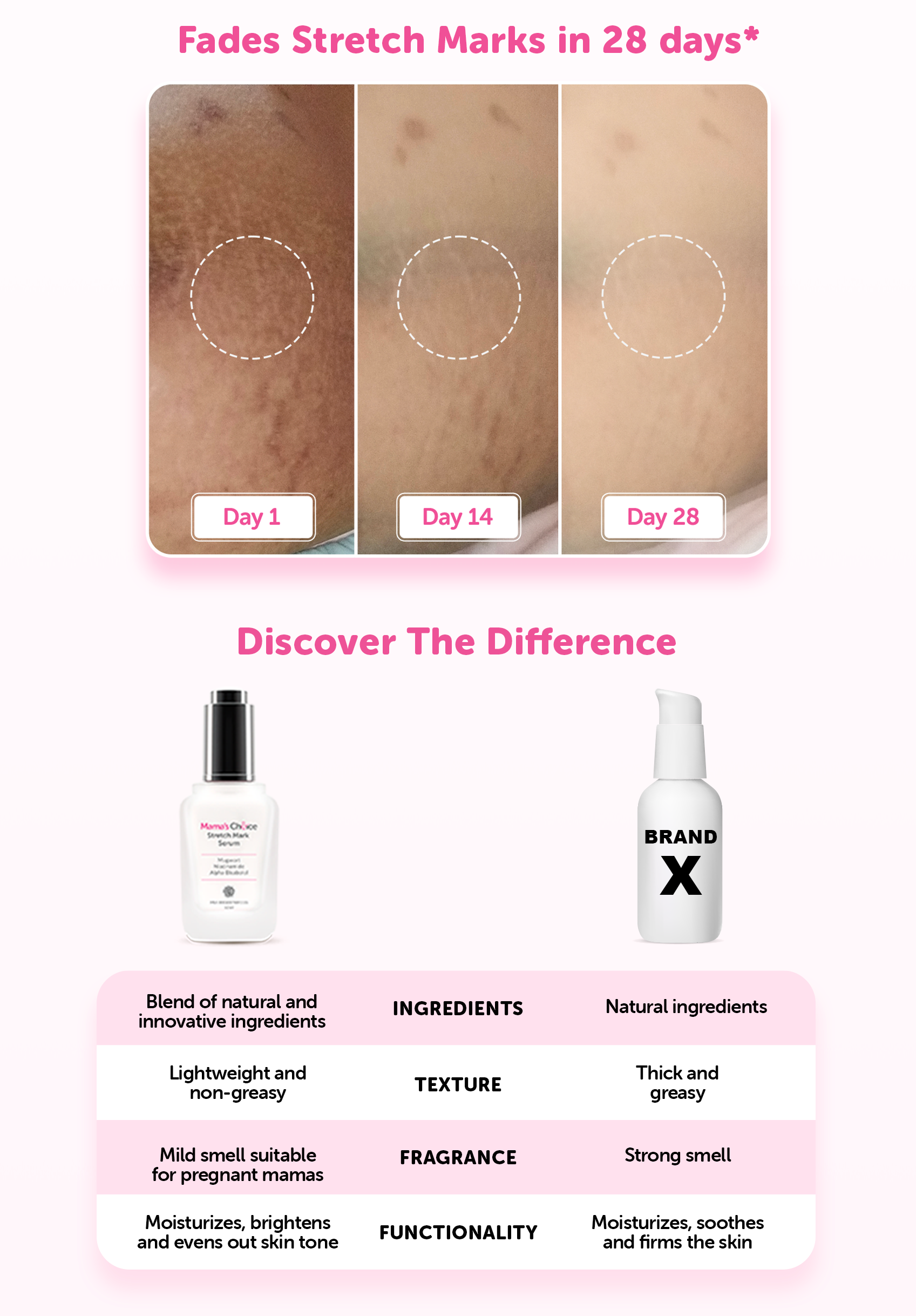 Mama’s Choice Stretch Mark Serum | Fades Stretch Marks & Dark Spots ...