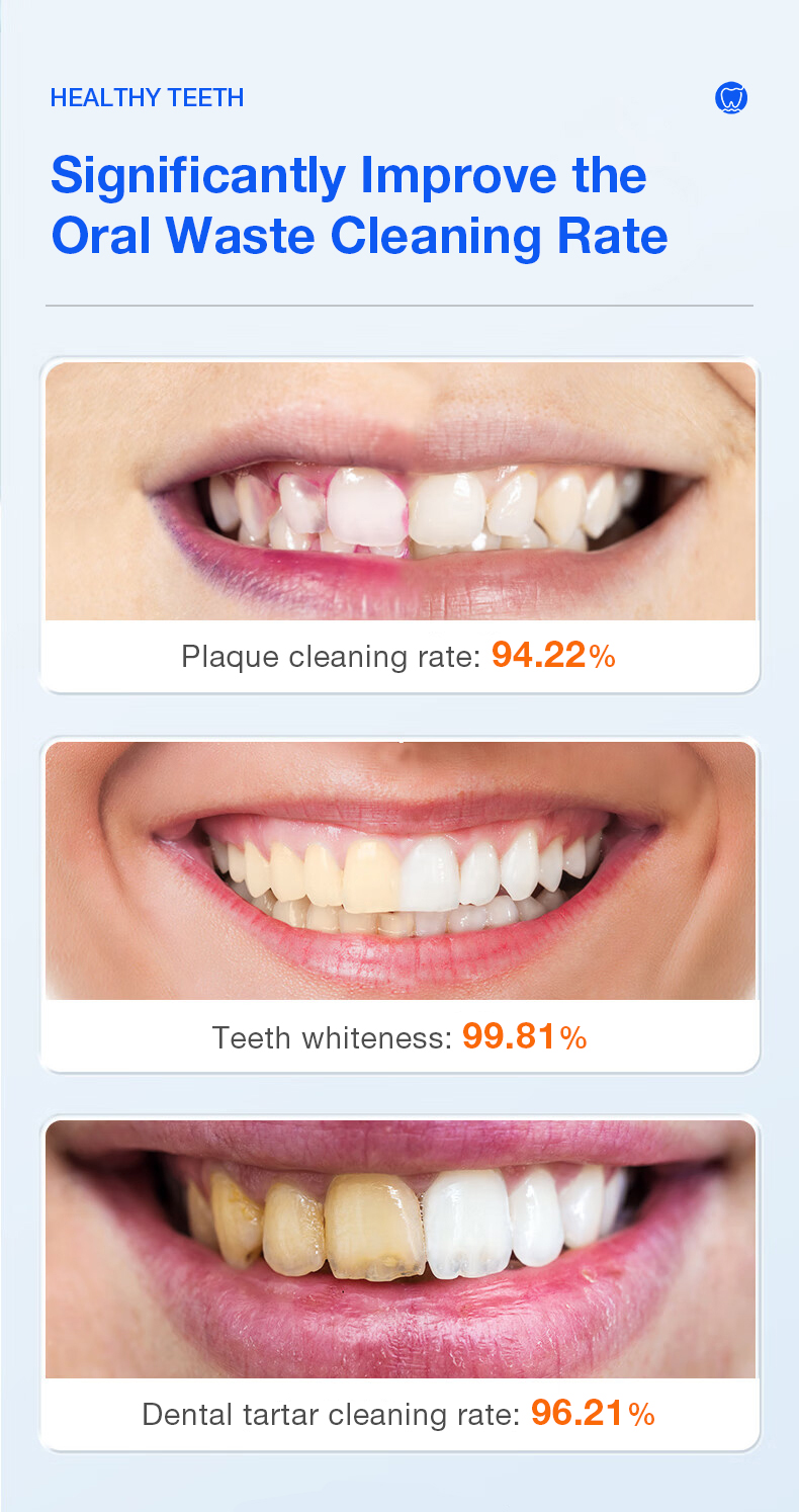 Airuidu CF500 Electric Water Flosser With 4 Head 160ML Water Floss ...