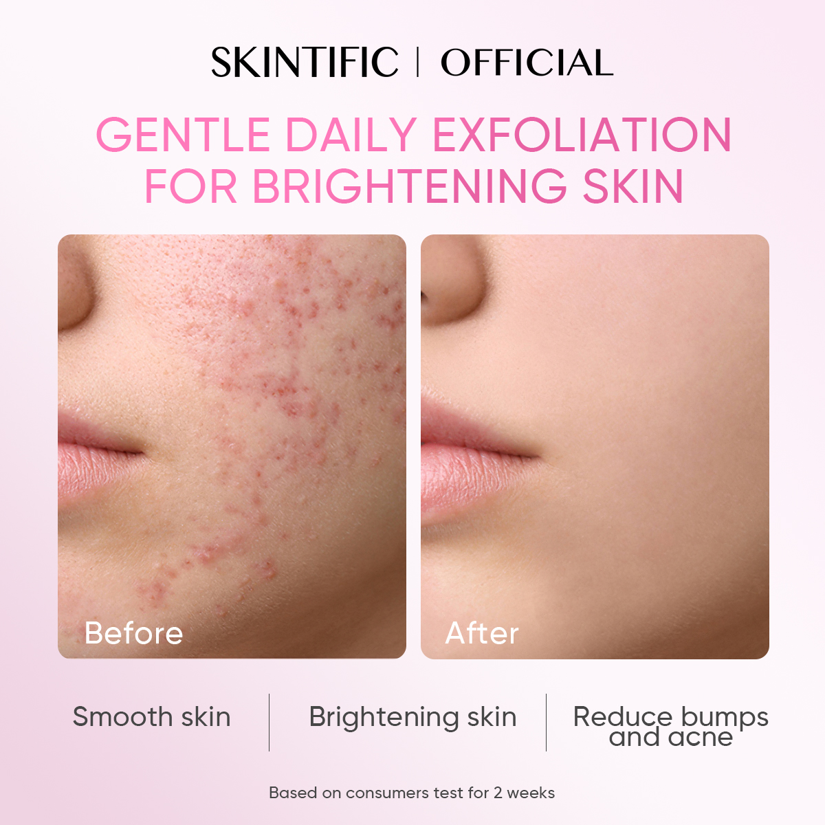 SKINTIFIC Glycolic Acid Daily Clarifying Toner Brighten and Smoothen ...