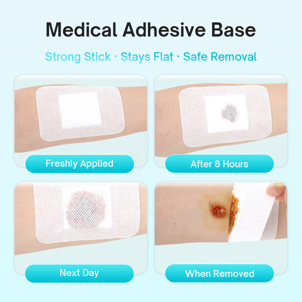 Medical Sterile Wound Dressing Patch Breathable Cotton Dressing Self ...