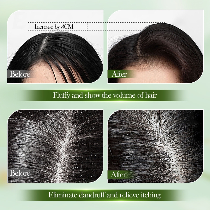 Oil Control Shampoo 520ml Argan Oil, Lemon Ginger Plant Essence Shampoo ...