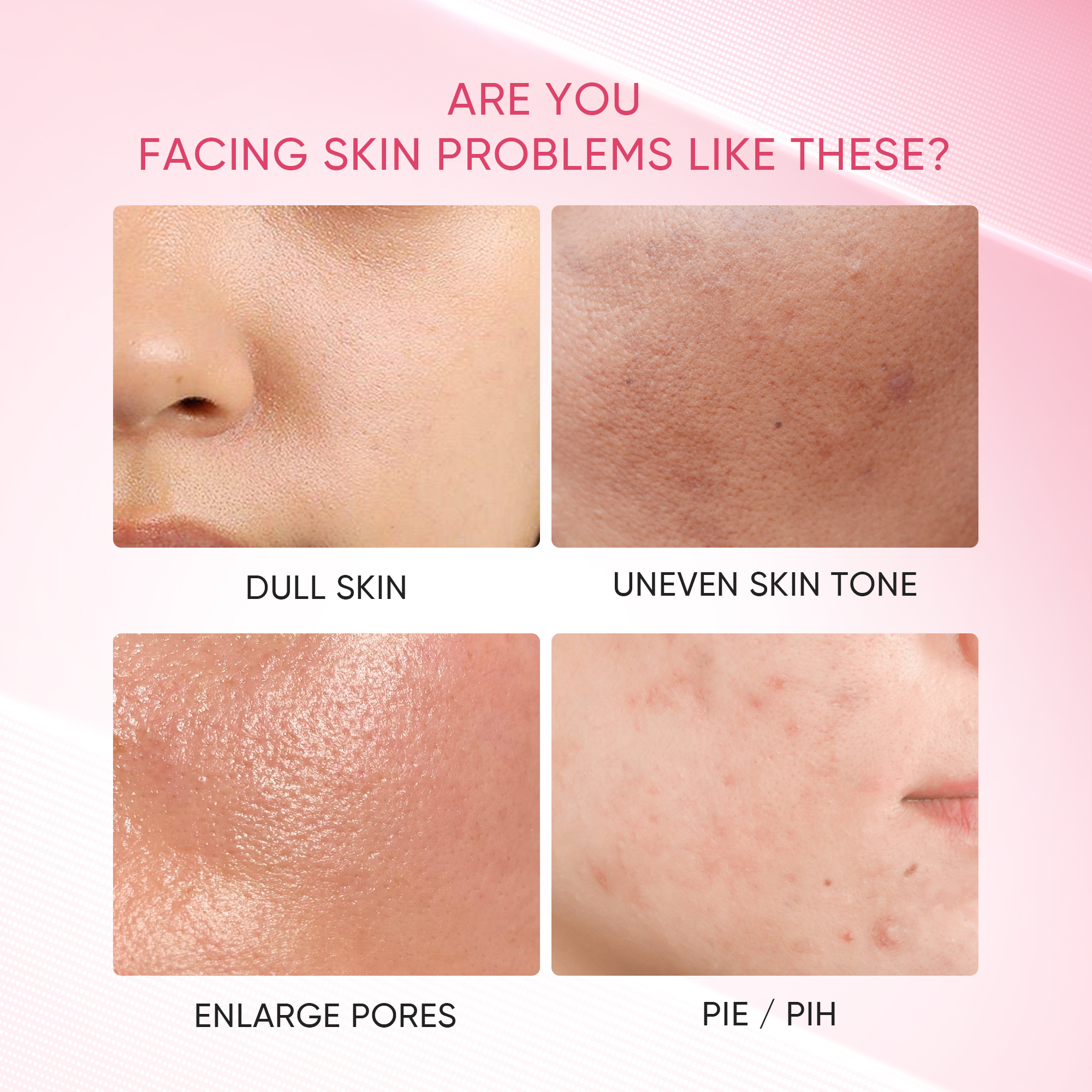 3pcs-SKINTIFIC Clay Mask Stick Niacinamide Brightening，Mugwort Acne ...