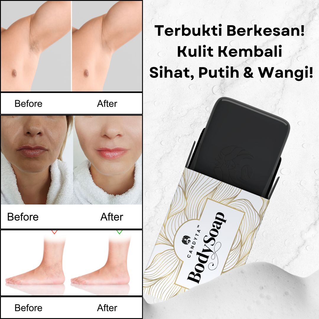 [Direct Dari HQ] Candyta Body Soap sabun daki badan dan pemutih celah ...
