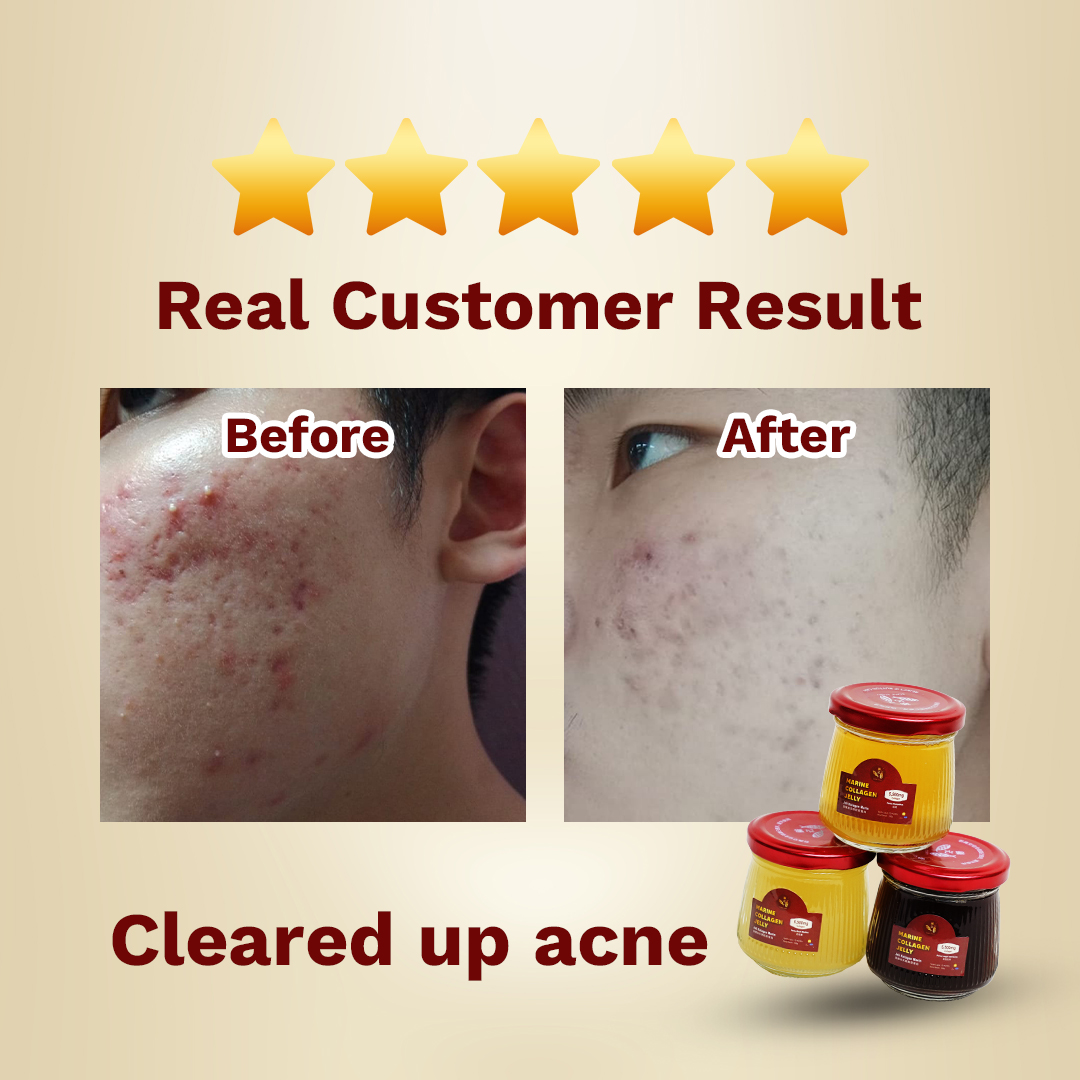 Scale Story 🐟 LingJi Fish Scale Collagen Beauty Anti Aging Deep Sea ...