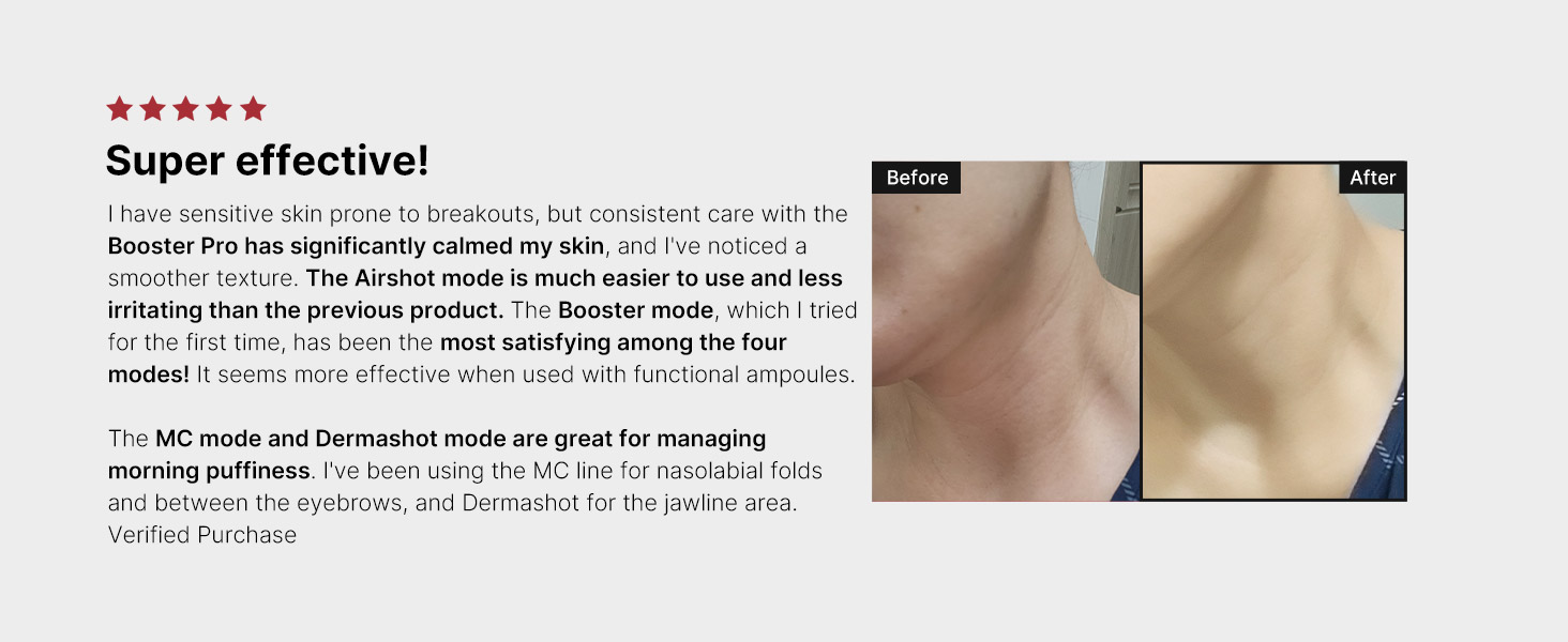 [medicube official] AGE-R Booster Pro Pink + PDRN | Beauty Tool | Glow ...