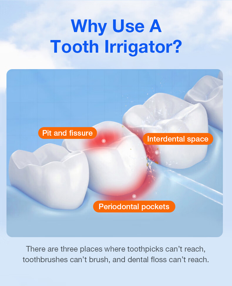 Airuidu CF500 Electric Water Flosser With 4 Head 160ML Water Floss ...