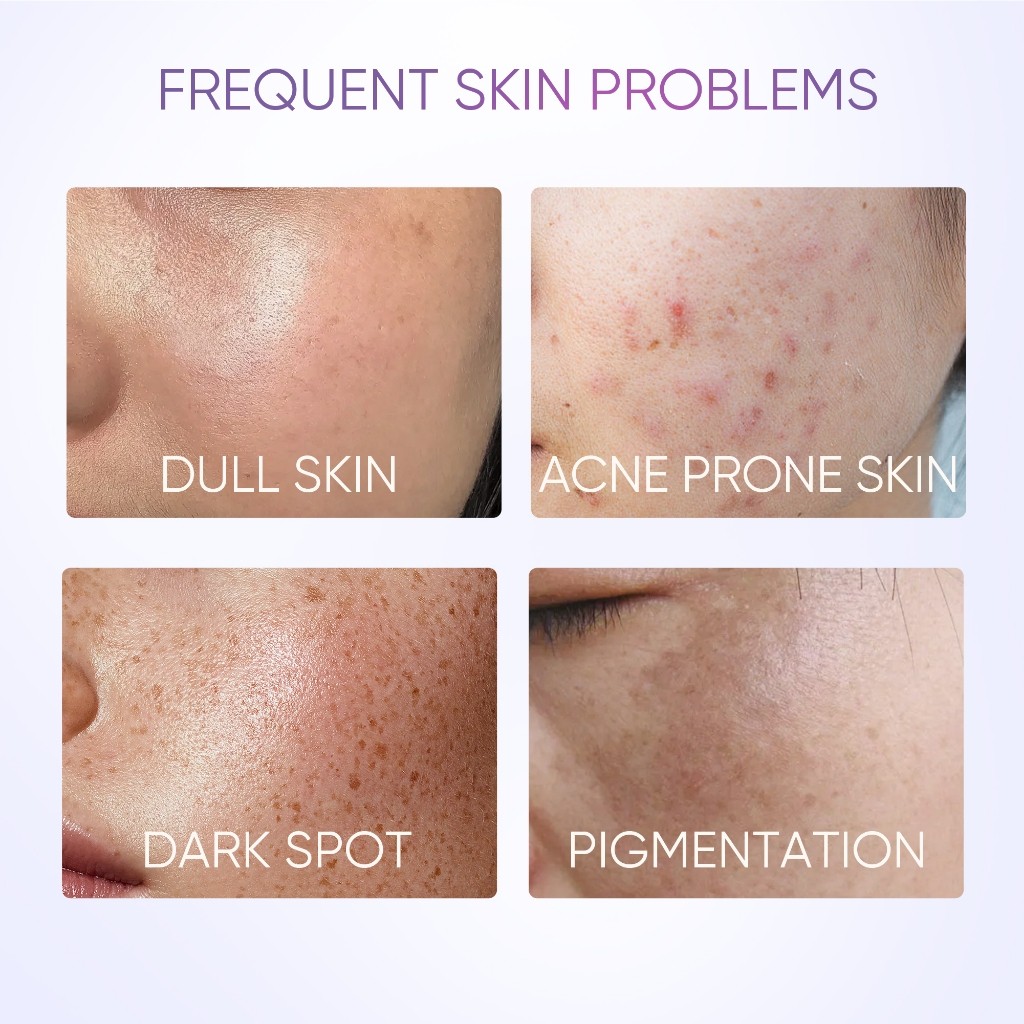SKINTIFIC Sym White 377 Dark Spot Serum muka with Niacinamide ...