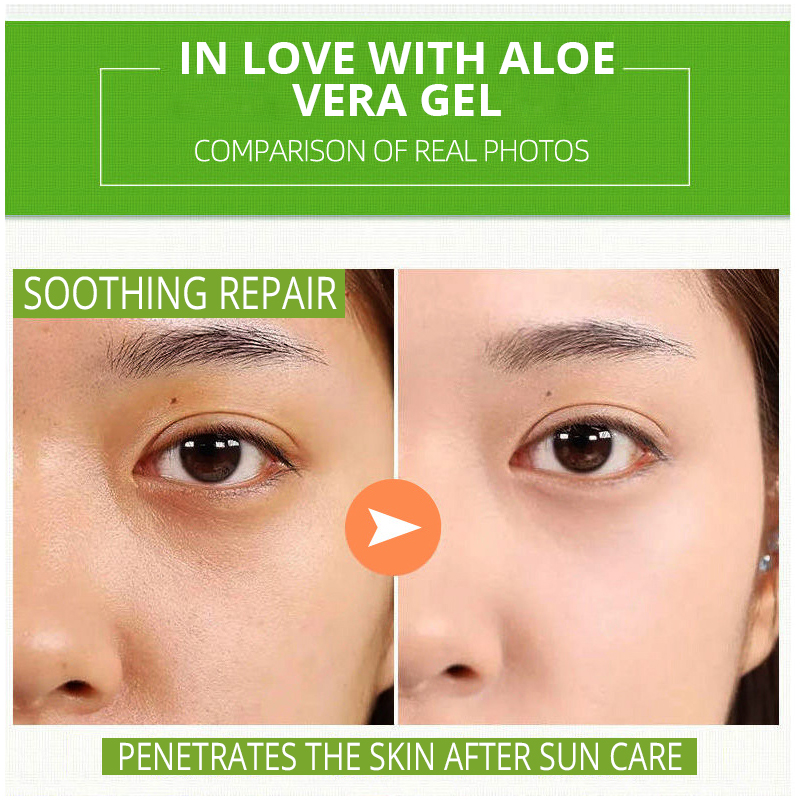 Aloe Vera Gel 300ml Large-Capacity Moisturizing Hydrating Acne Gel Mild ...