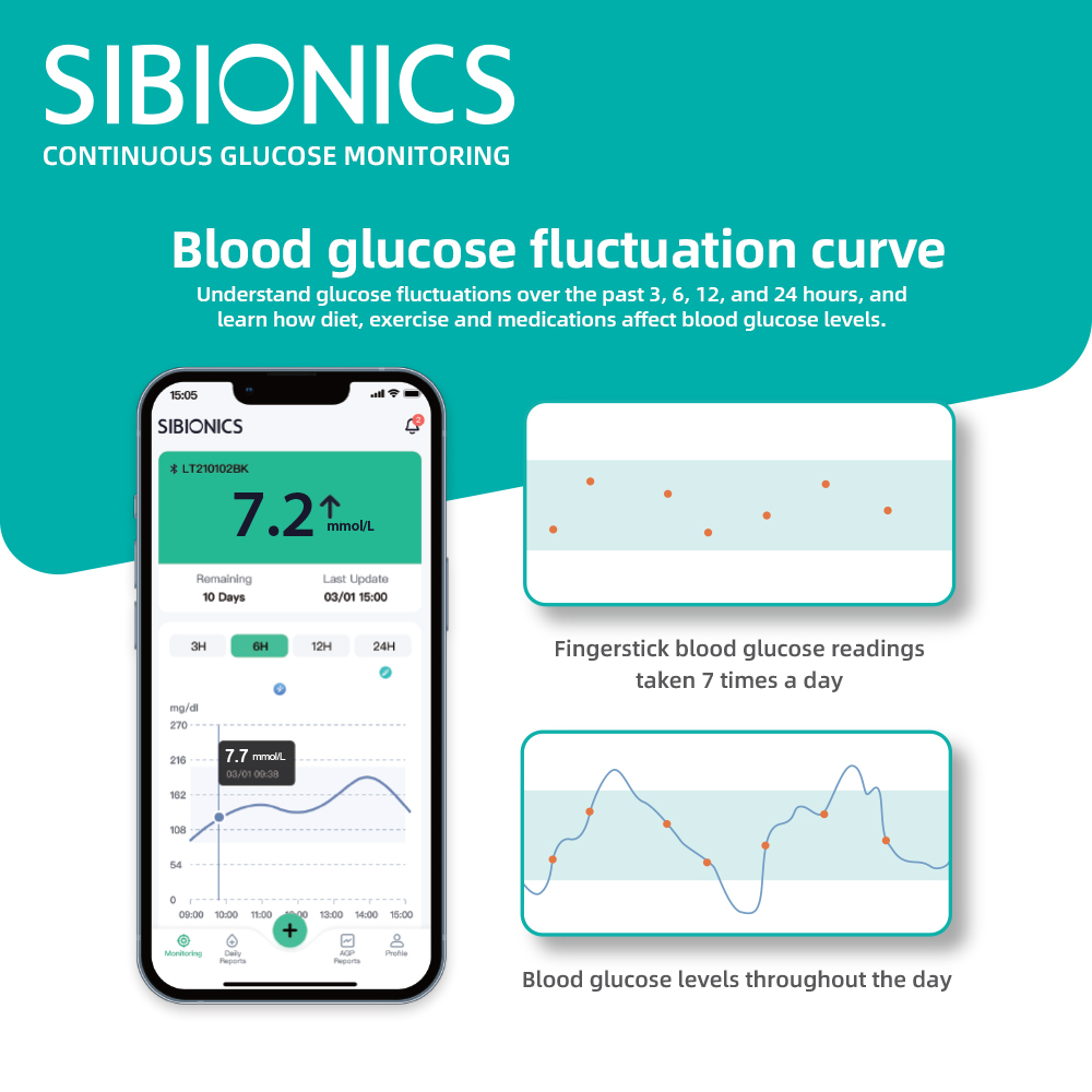 SIBIONICS CGM - 24 hours Continuous Glucose Monitoring System GS1 ...