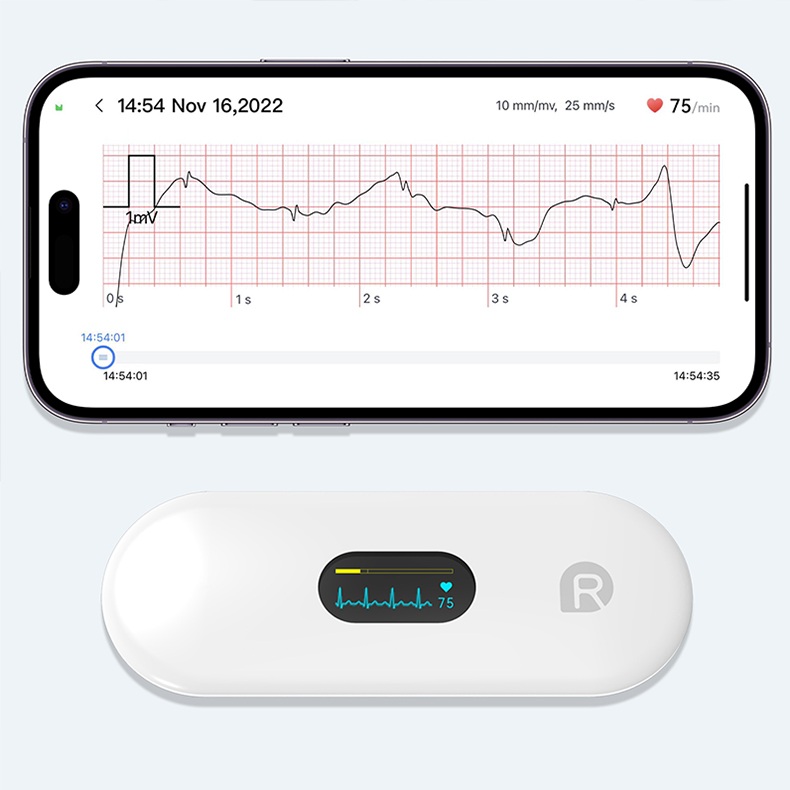 Lepu Medical Portable Instant ECG Device Heart Health Monitor ...