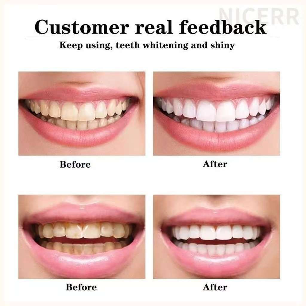 🔥READY STOCK🔥[100% ORI]NEW PACKAGING!Ubat Gigi Amway Toothpaste Glister ...
