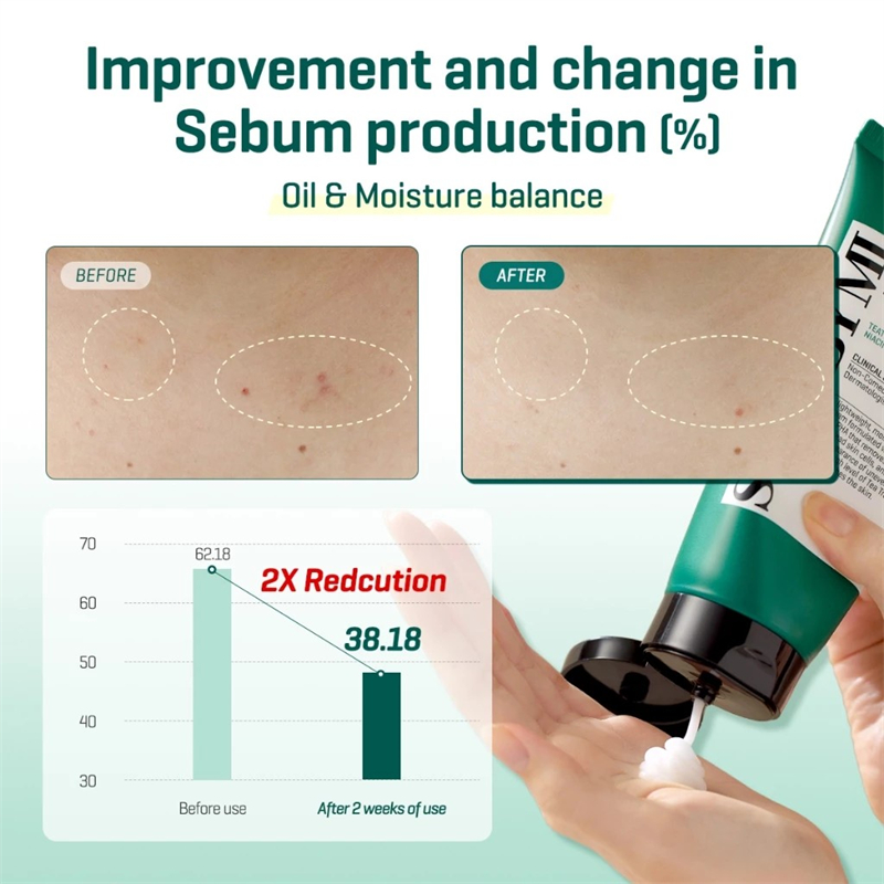 SOME BY MI Tea Tree Toner/Yuzu Toner/Cleanser/Acne Foam Cleanser ...