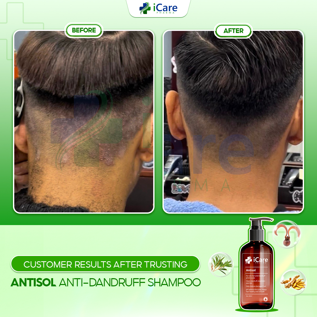 Antisol Anti-Dandruff Shampoo – Herbal Formula for Itchy & Fungal Scalp ...