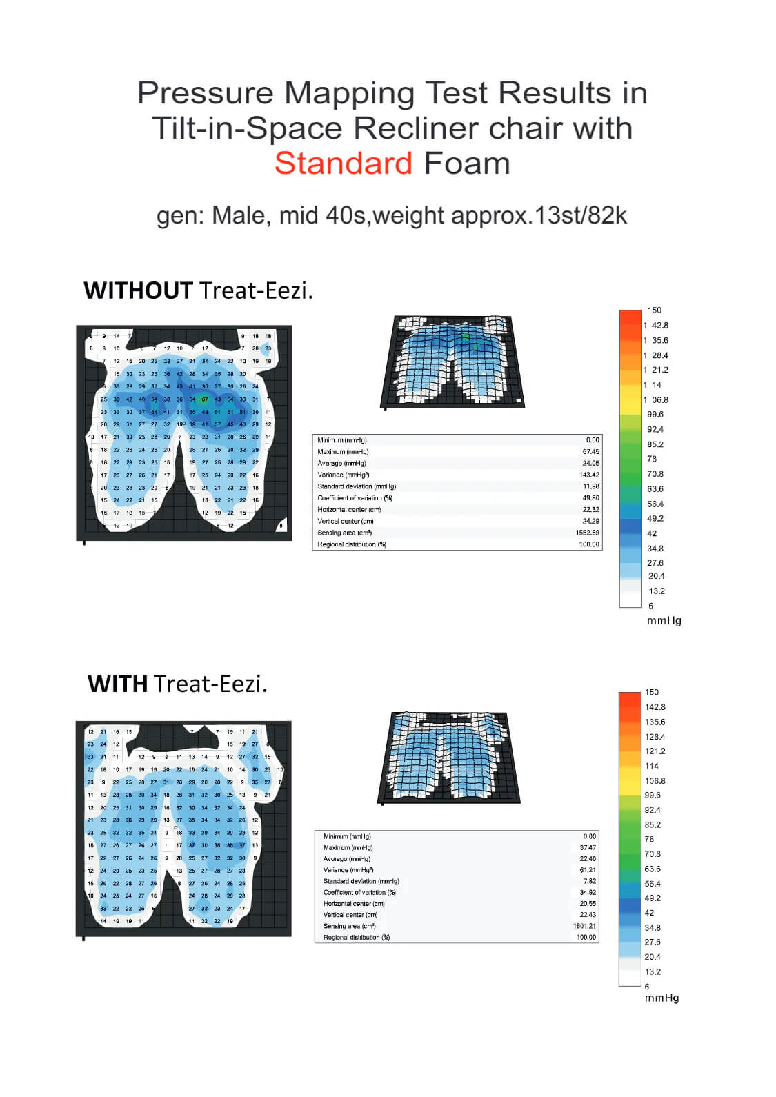 Full Length Pressure Relieving Mattress Overlay | Treat-Eezi | Shopee ...