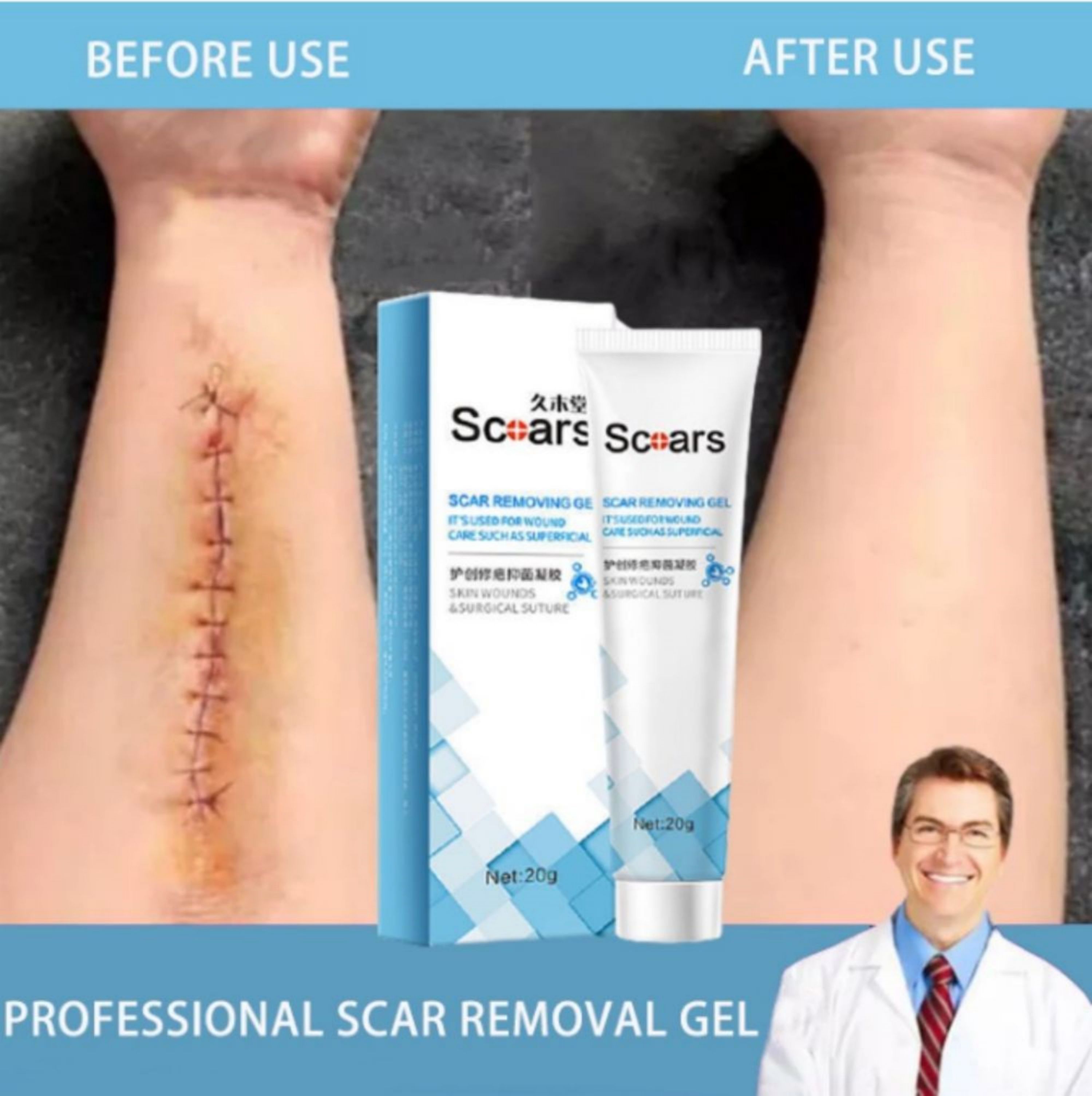Scar Removal Cream Treatment Remove Stretch Marks Burns Scald Repair ...