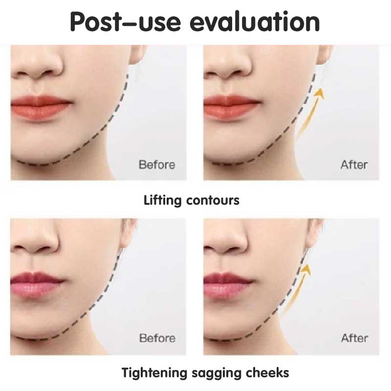 v shape face lifting firming face mask v shape mask v脸面膜 瘦脸面膜 | Shopee ...
