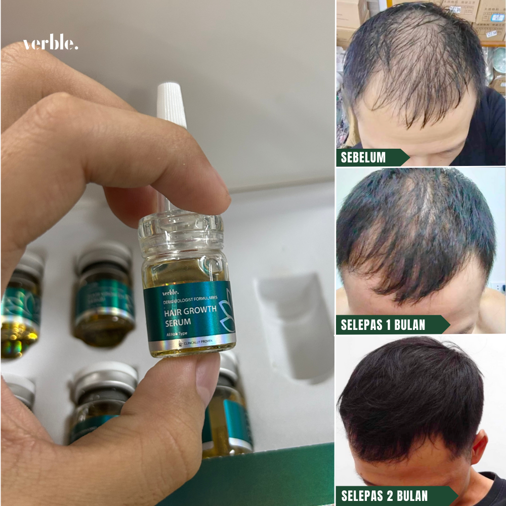 VERBLE x KIREI Combo Fresh & Strong Verble Hair Growth Serum Erhair ...
