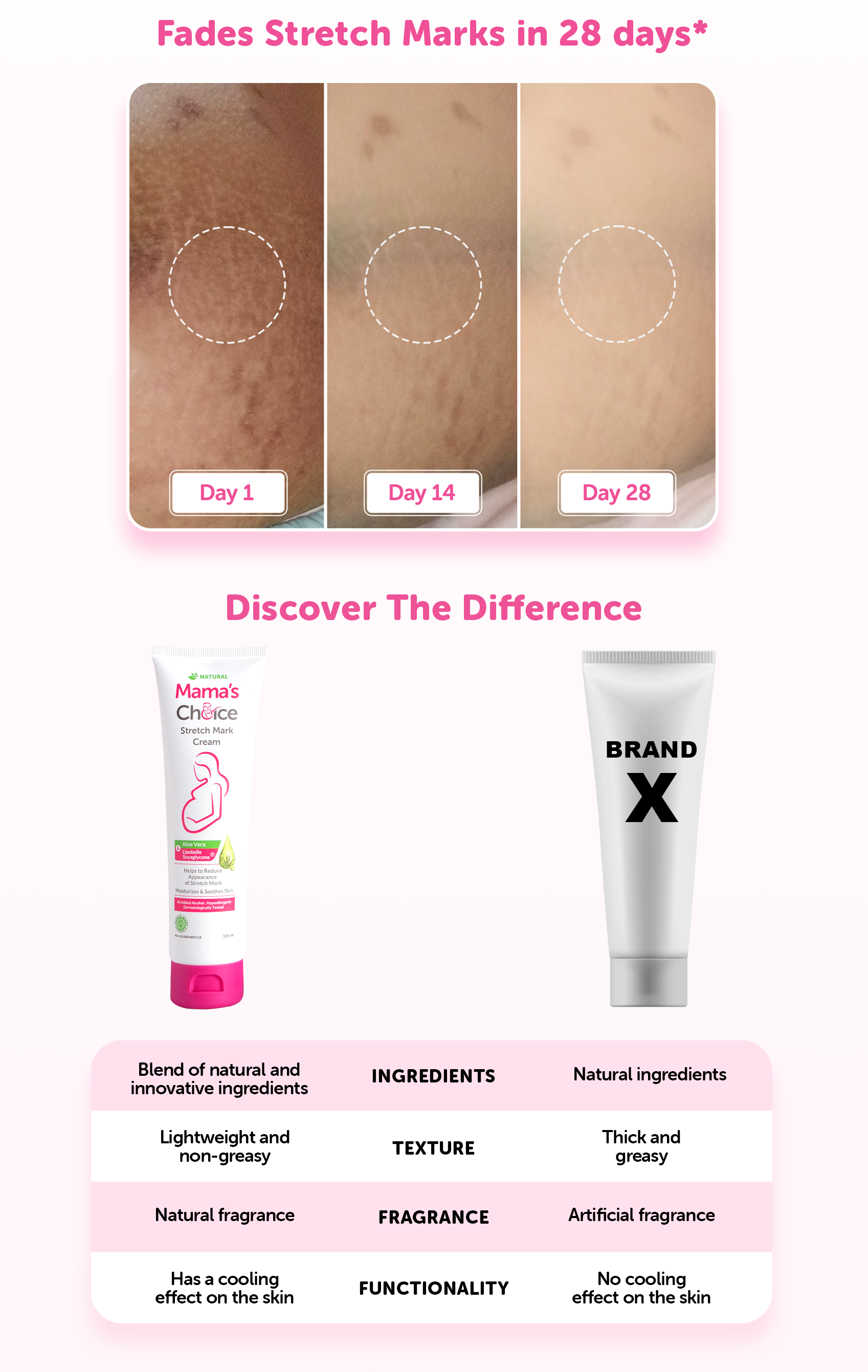 Mama's Choice Stretch Mark Cream | Krim Stretch Mark (Safe, Halal ...