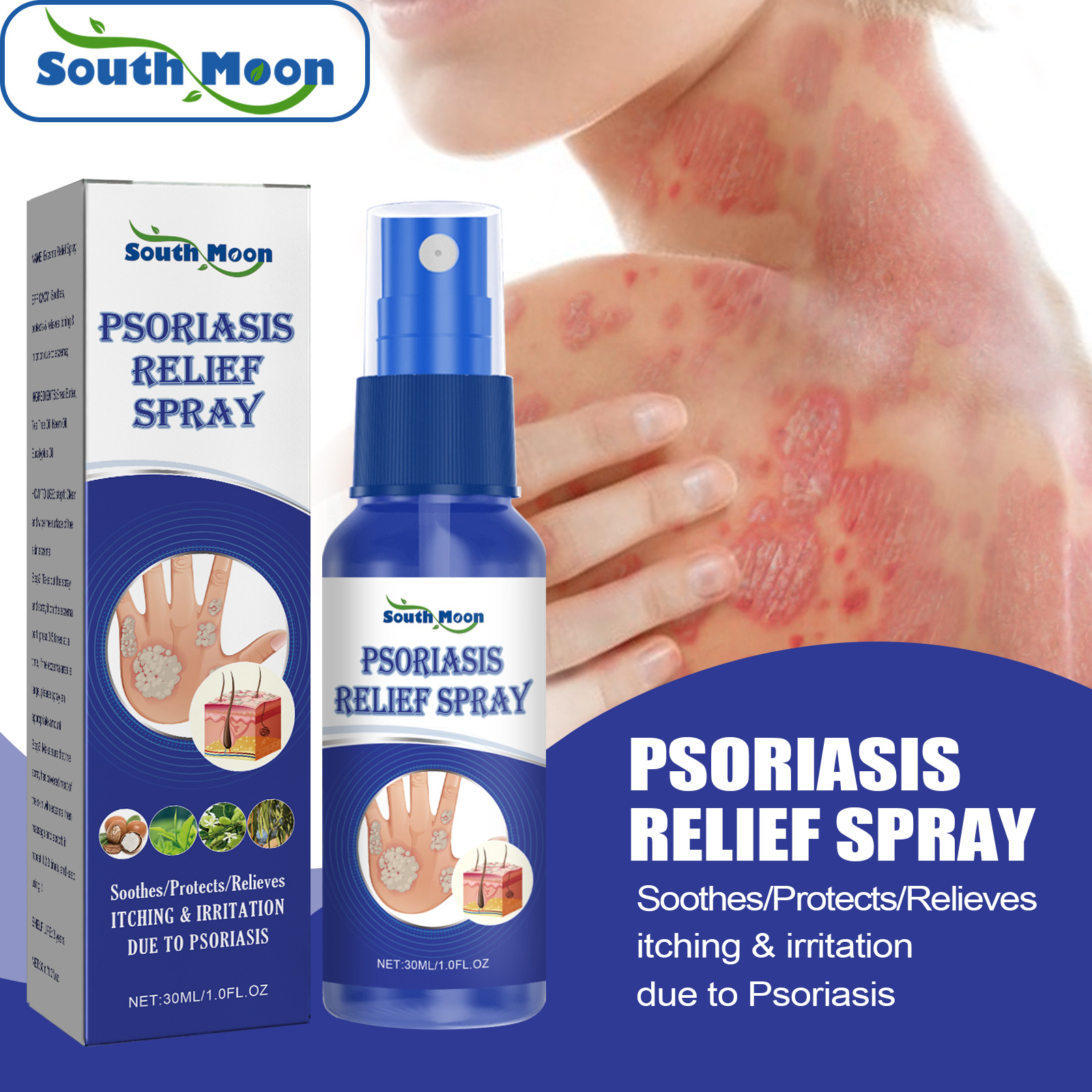 Psoriasis spray anti itch Eczema Spray ubat kurap ubat gatal kulit ...