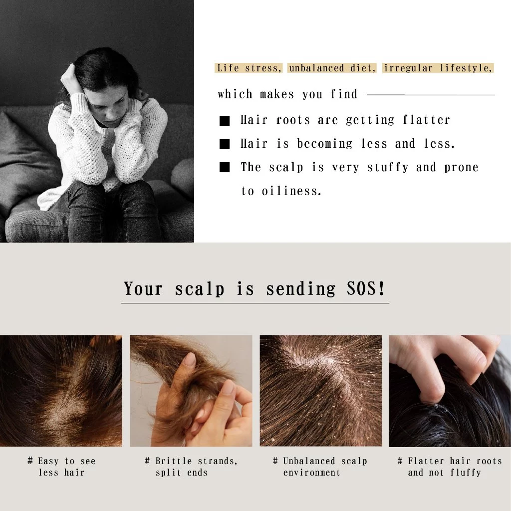 KAFEN Anti Hair Loss Series - Shampoo / Essence | Balance Oil Reduce ...
