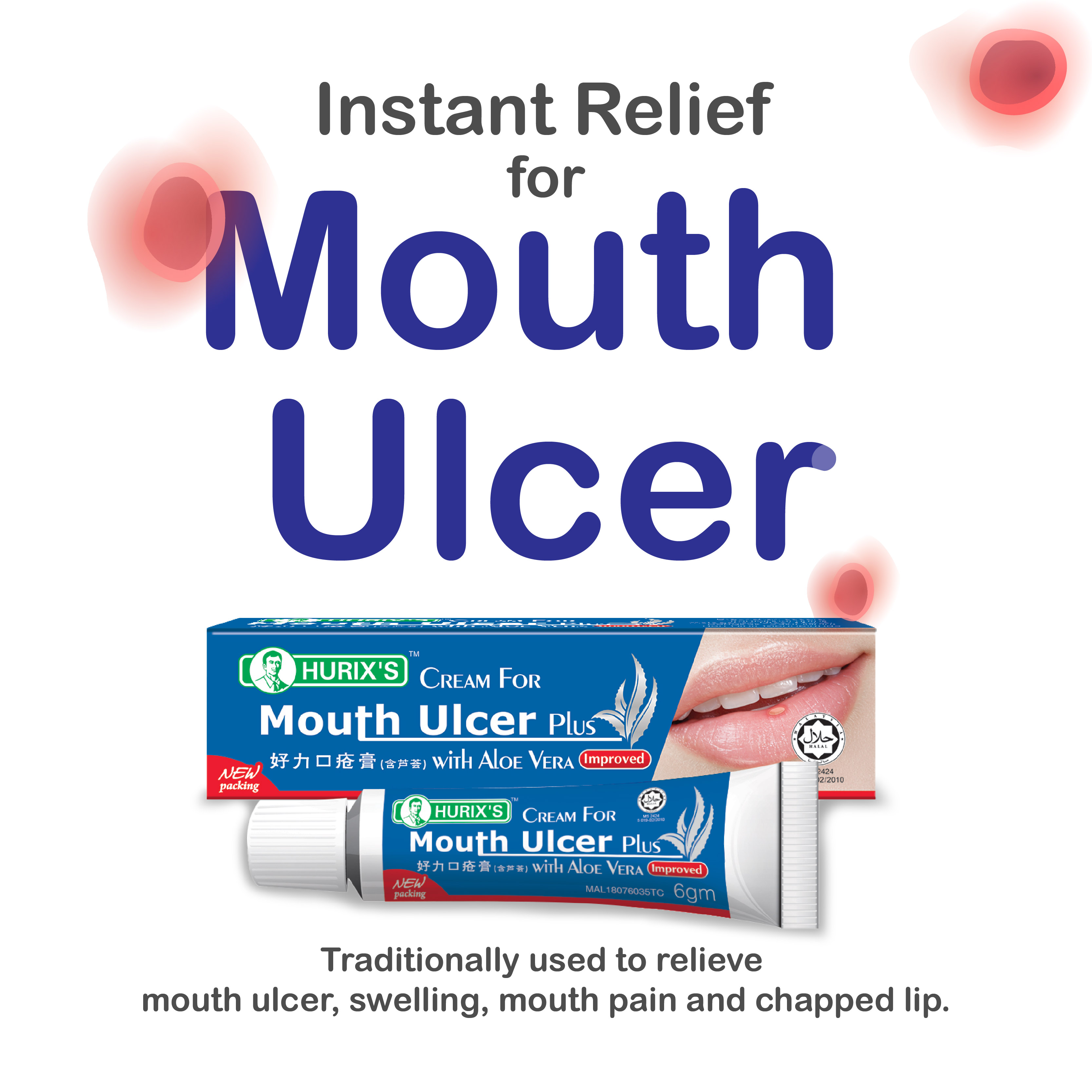 HURIX'S Cream for Mouth Ulcer (with Aloe Vera) Improved (6gm) - Krim ...
