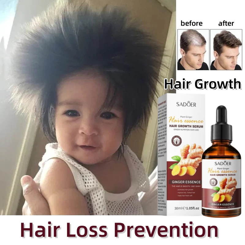 Hair growth serum Lebatkan rambut Serum rambut gugur Hair Grower Fast ...