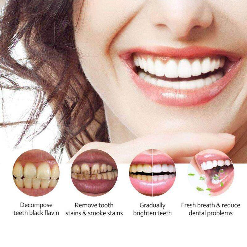 YAYASHI SP-4 Toothpaste Ultra Plus Super Probiotic Whitening Toothpaste ...