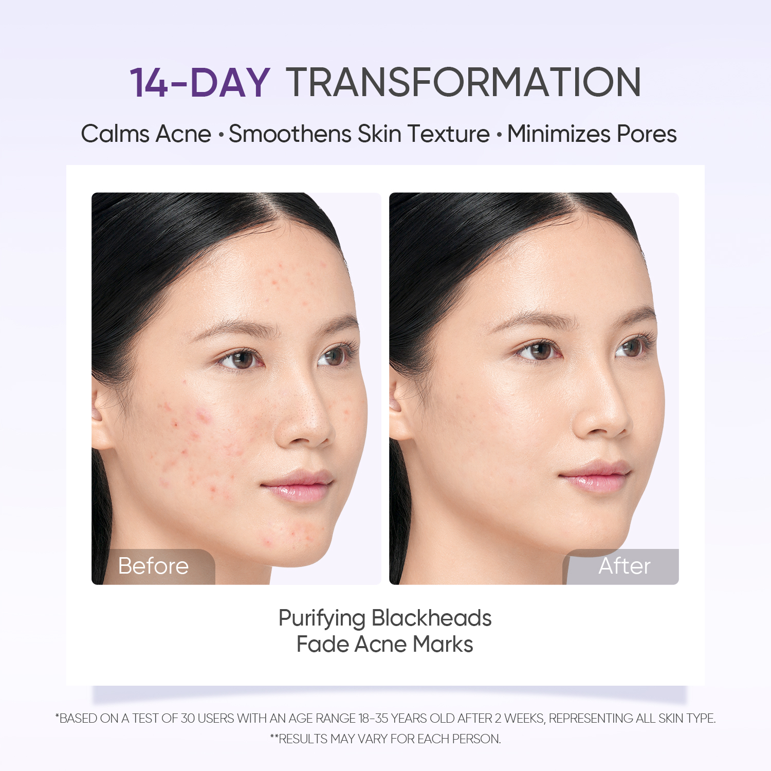 SKINTIFIC Lactic Acid Skin Renewal Exfoliating Serum muka Acne ...