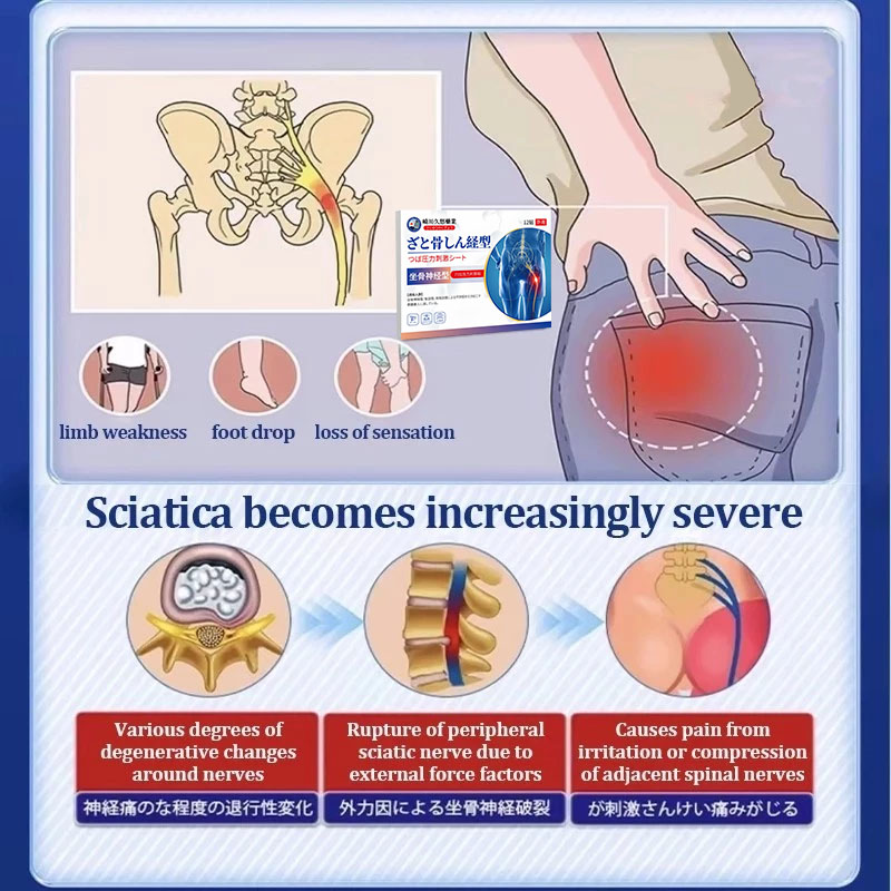 sciatica pain relief patch 12 pcs/box back joint shoulder lumbar bone ...