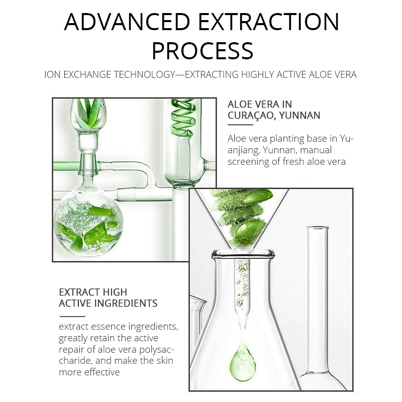 Aloe Vera Gel 300ml Large-Capacity Moisturizing Hydrating Acne Gel Mild ...
