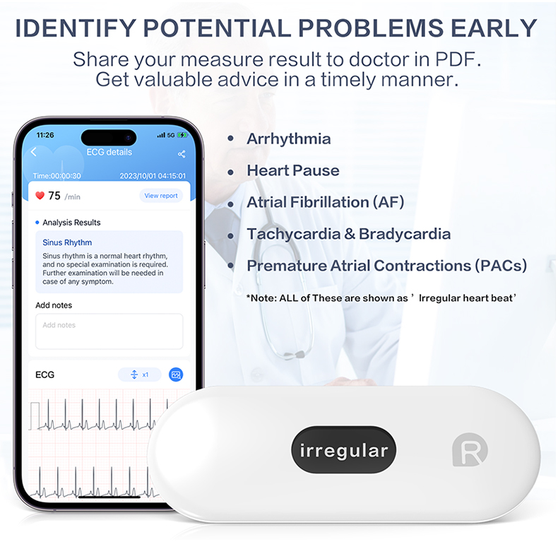 Lepu Medical Portable Instant ECG Device Heart Health Monitor ...
