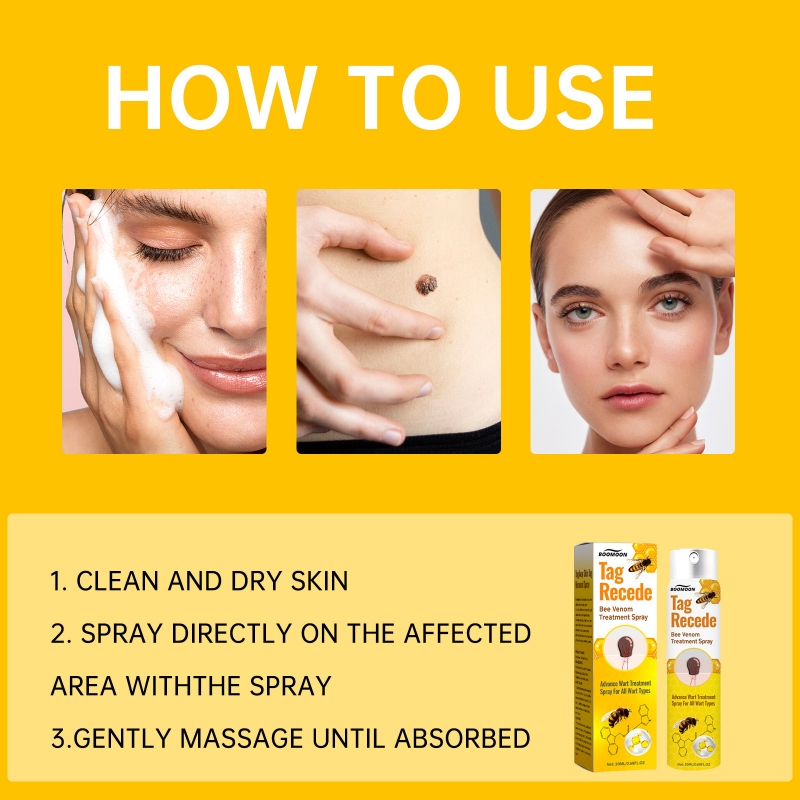 Tag Recede Bee Venom Spary Wart Remover buang tahi lalat Ubat kutil ...