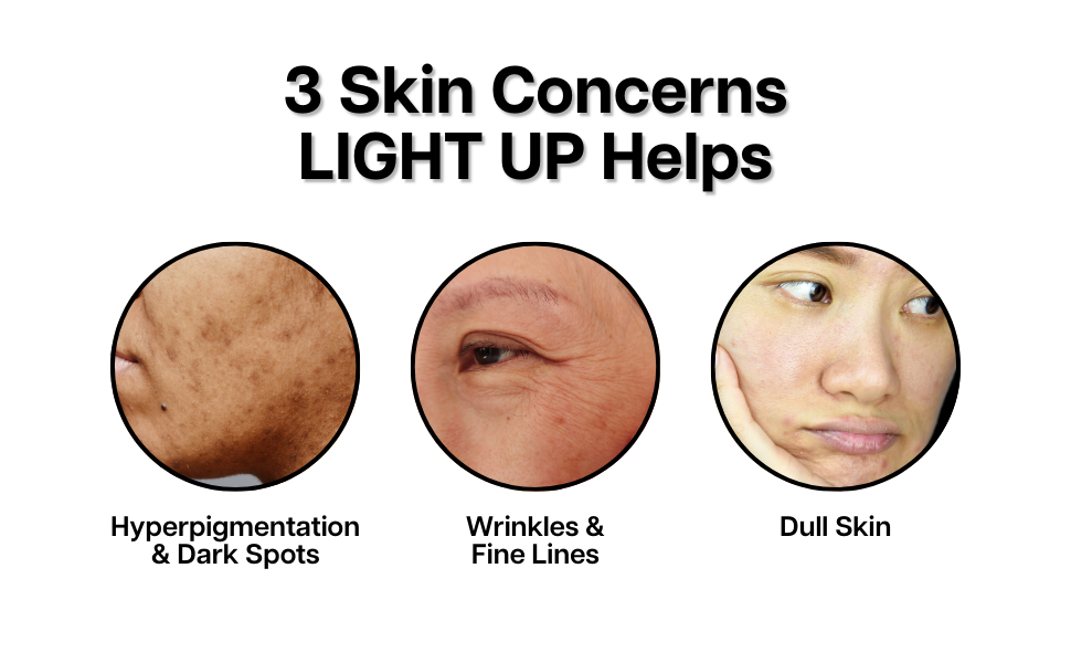 Ventamin LIGHT UP Skin Brightening Pigment Jeragat Oral Supplement Fern ...