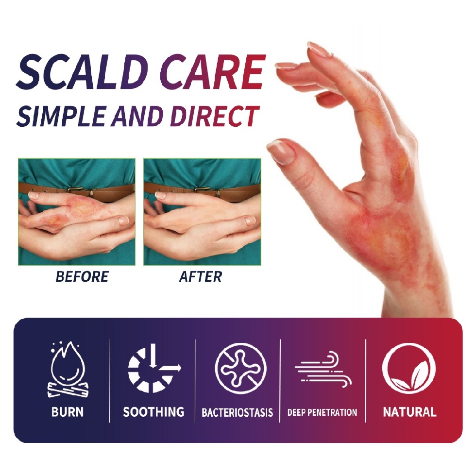 Burn Care Cream 20g scar care Burn and Scald Care Ointment Relieve ...