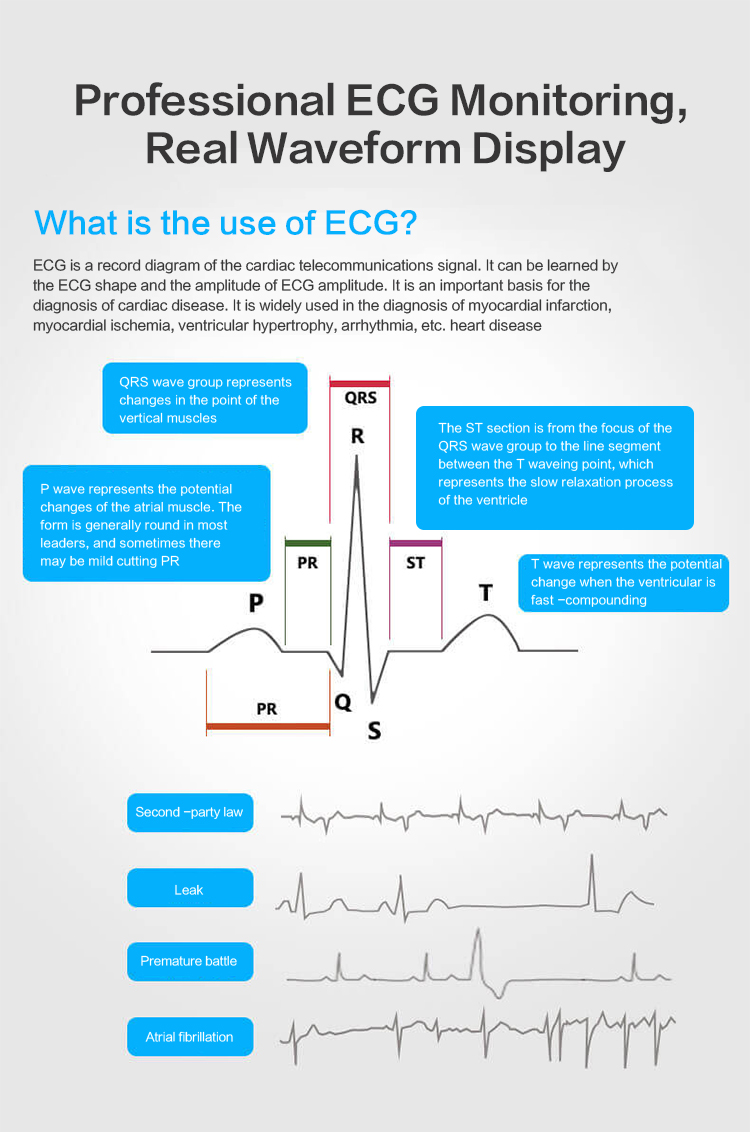 Lepu Medical Easy ECG Monitor Portable Handheld Electrocardiogram ...