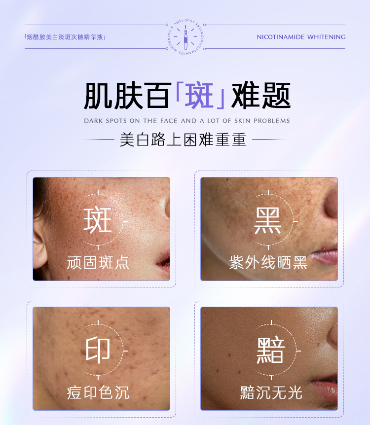 🔥现货💯正品 +free gift🎁 NACO NICOTINAMIDE WHITENING & ANTI-SPOT ESSENCE ...