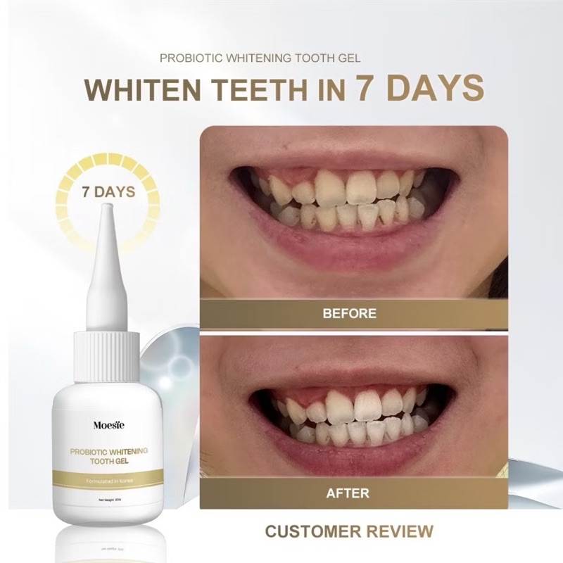 【现货秒发】Moesie 韩国医美级美白牙凝胶20g(提供官方单据 100%正品)Exp:2027| Moesie Probiotic ...