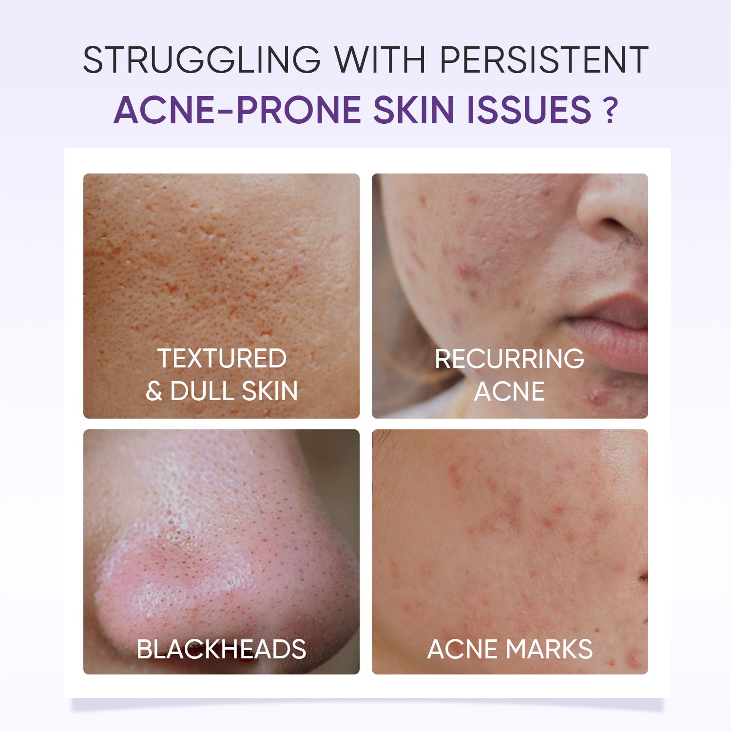 SKINTIFIC Lactic Acid Skin Renewal Exfoliating Serum muka Acne ...