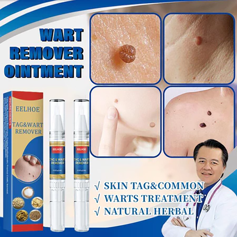 🔥【Ready Stock】Upgraded Ubat Ketuat Tahi Lalat Skin Tag Remover Pen ...