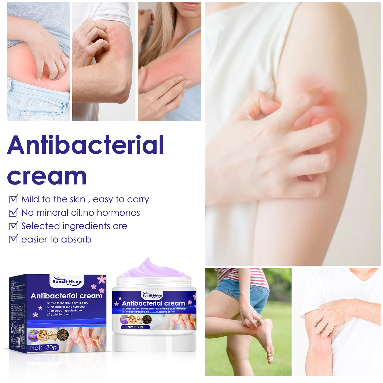 South Moon Anti bacterial Eczema Cream 30g 抗菌止痒膏 Anti-Itch Psoriasis ...